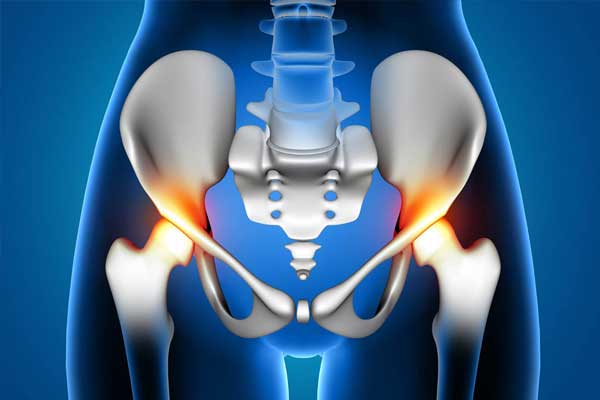 درد لگن و کشاله ران در زنان ️ دلایل، علائم + درمان‌